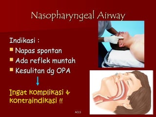 acls-airway-baru1. untuk keperawatan mahasiswa | PPT