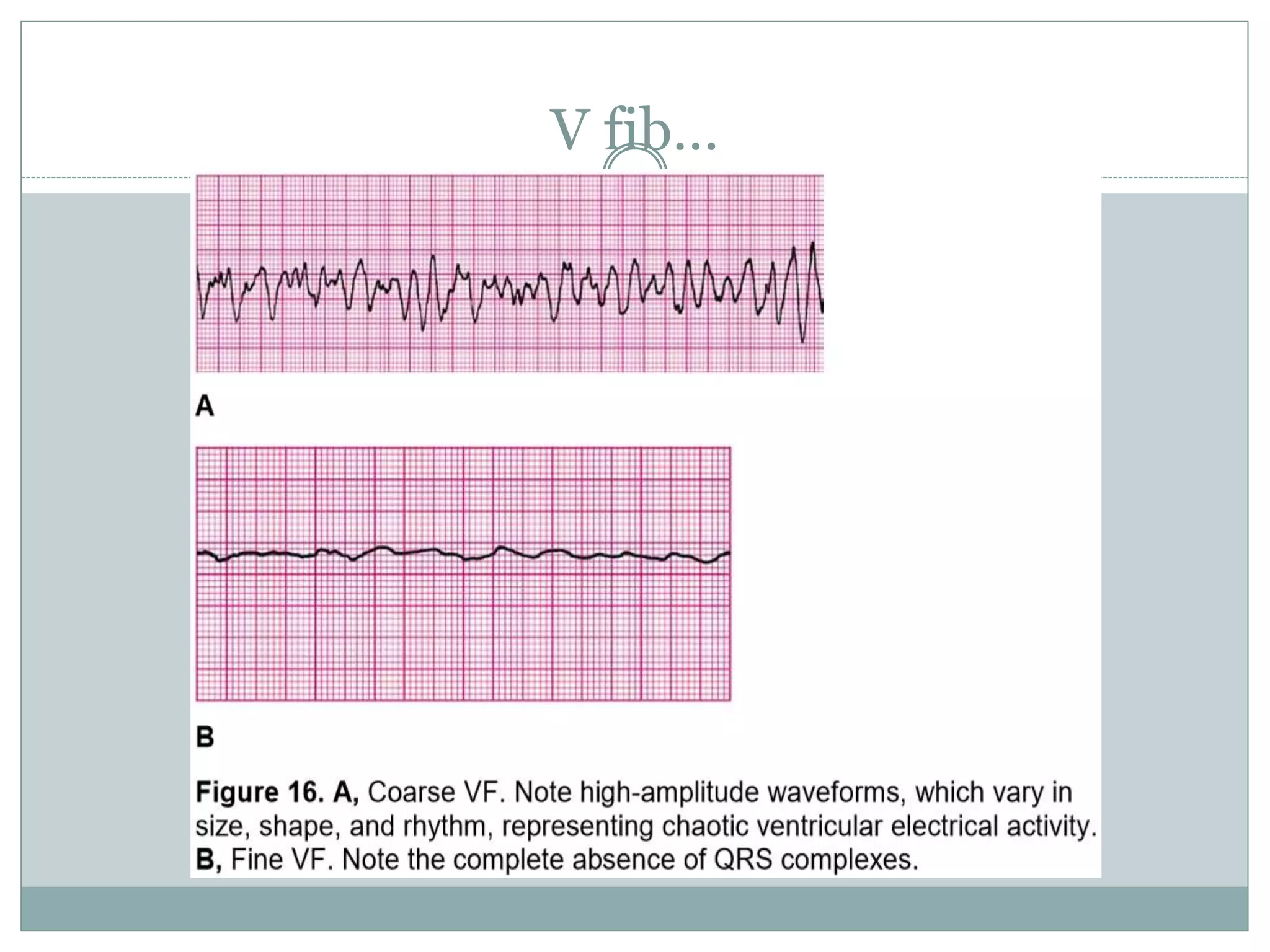 Adult cardiac life support(ACLS) | PPTX