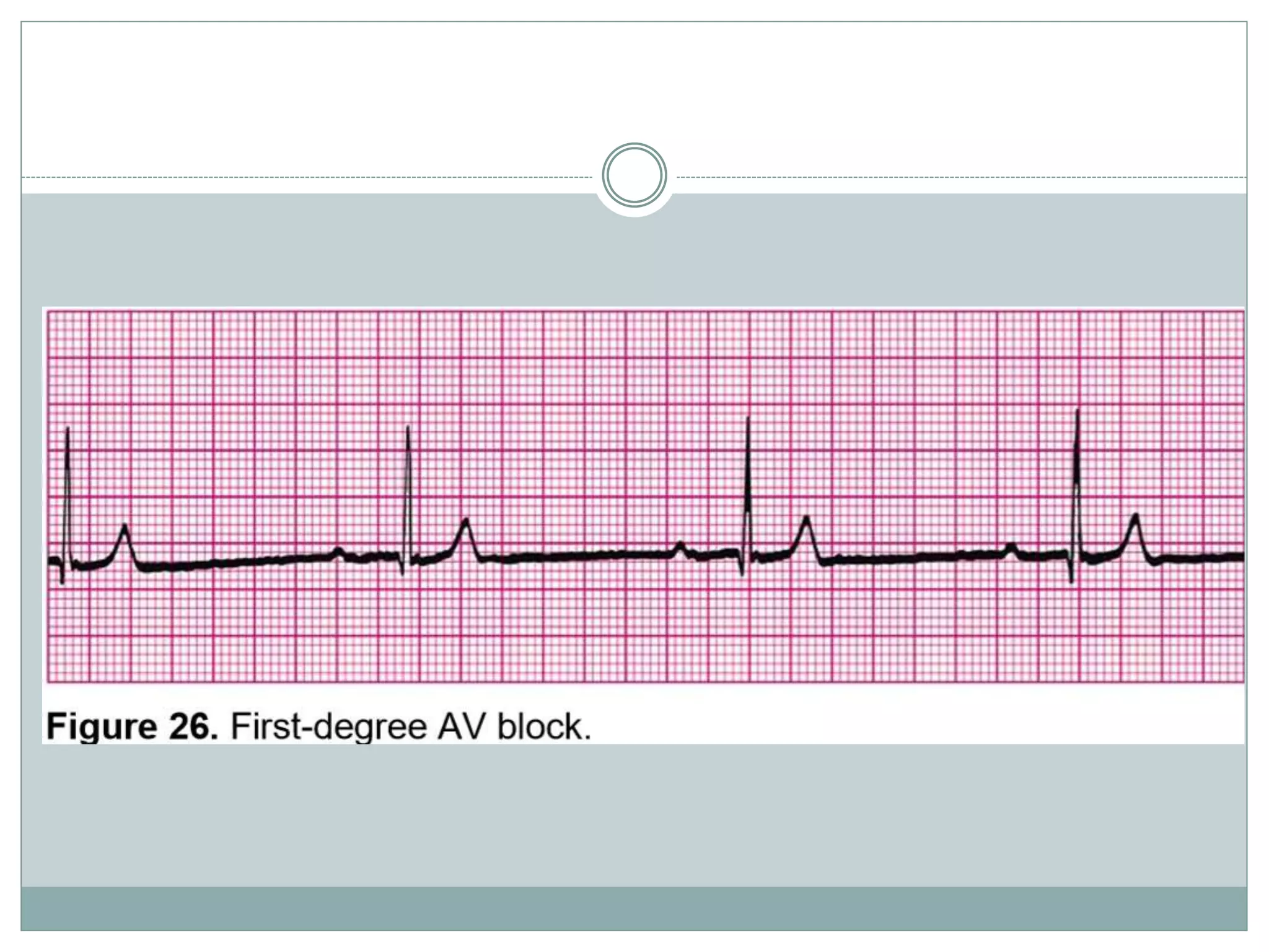 Adult cardiac life support(ACLS) | PPTX