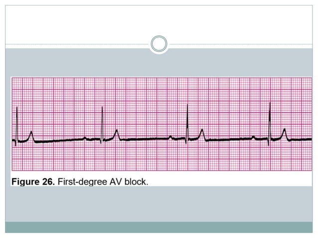 Adult cardiac life support(ACLS) | PPTX | First Aid | Injuries