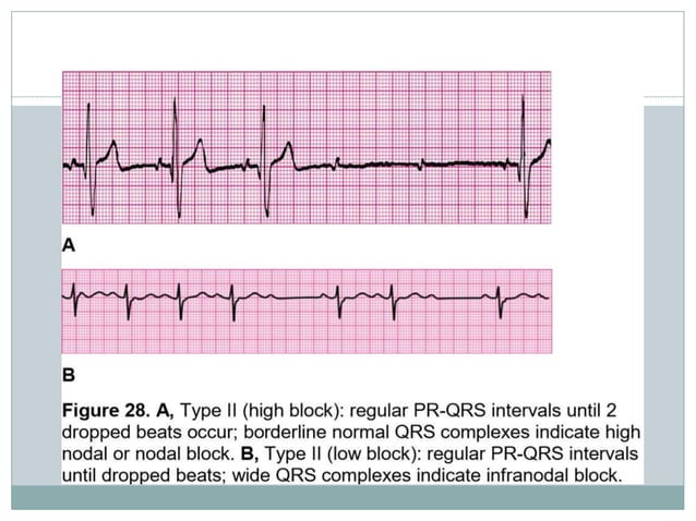 Adult cardiac life support(ACLS) | PPTX | First Aid | Injuries