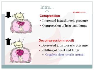 Adult cardiac life support(ACLS) | PPTX