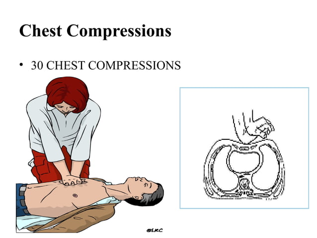 advanced Cardiac life support (ACLS), Shockable -non-shockable rhythm ...