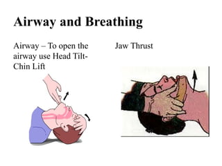 advanced Cardiac life support (ACLS), Shockable -non-shockable rhythm ...