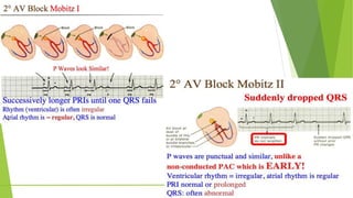 ACLS Algoritma (2).pptx