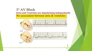 ACLS Algoritma (2).pptx