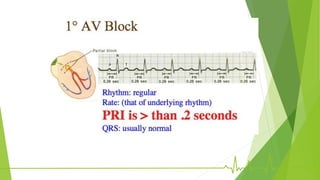 ACLS Algoritma (2).pptx