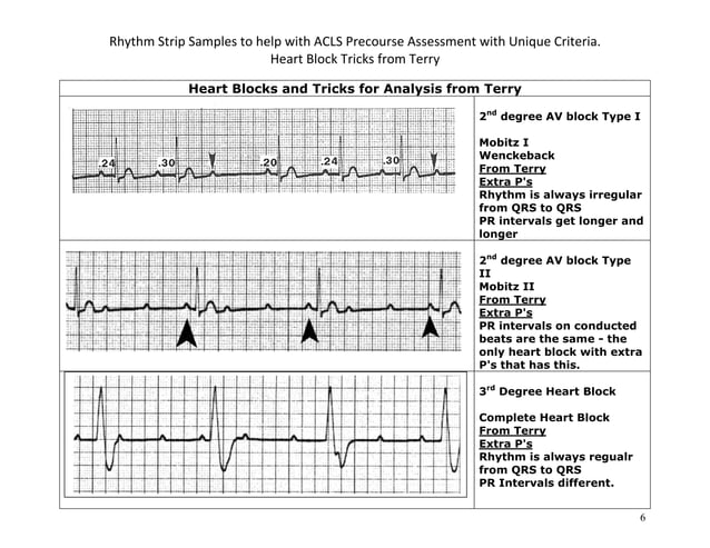 aclsCardiac_Dysrhythmia_Overview_to_help_with_ACLS_Precourse ...