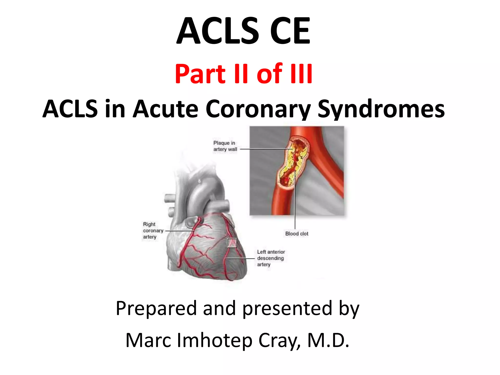 ACLS CE -Part II of III -BLS-CPR-ACLS in Acute Coronary Syndrome w Arrest | PPT