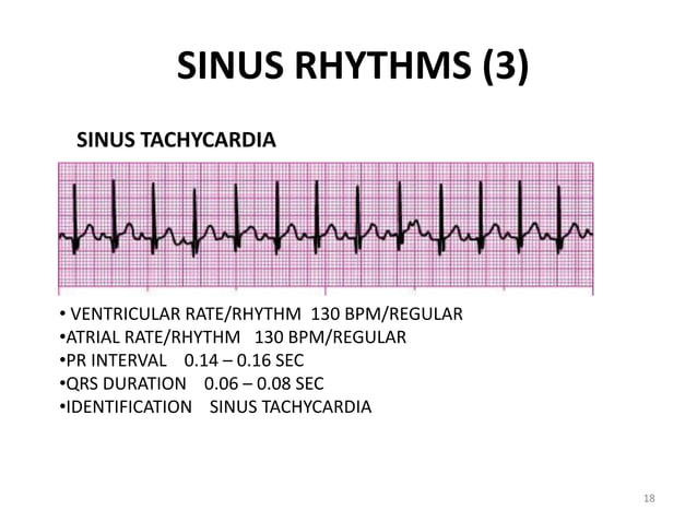 ACLS CE -Part I of III -ECG STRIP INTERPRETATION w Case Scenarios Supplemental | PDF