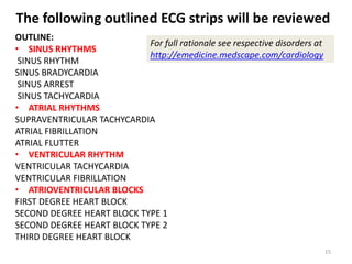 Cardiac Tamponade Rhythm Strip