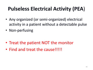 Pulseless Electrical Activity Ecg Strip