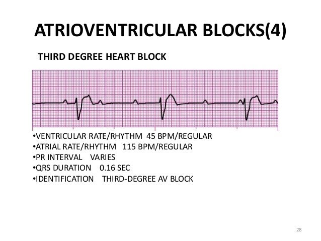 ACLS CE -Part I of III -ECG STRIP INTERPRETATION w Case Scenarios Sup…