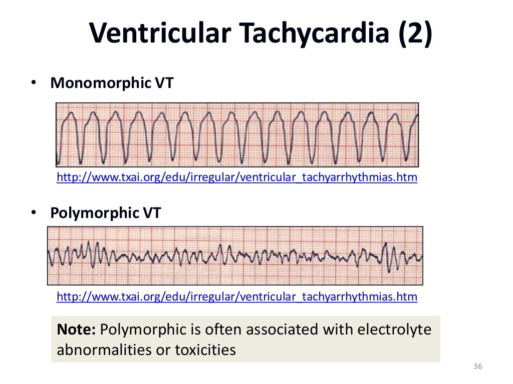 ACLS CE -Part I of III -ECG STRIP INTERPRETATION w Case Scenarios Sup…