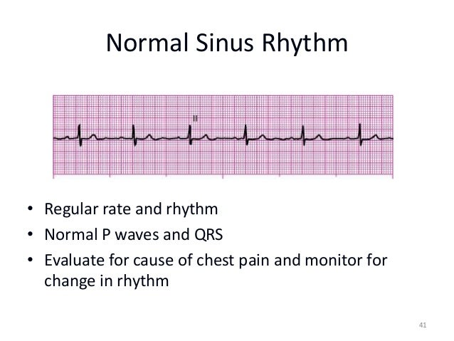 ACLS CE -Part I of III -ECG STRIP INTERPRETATION w Case Scenarios Sup…