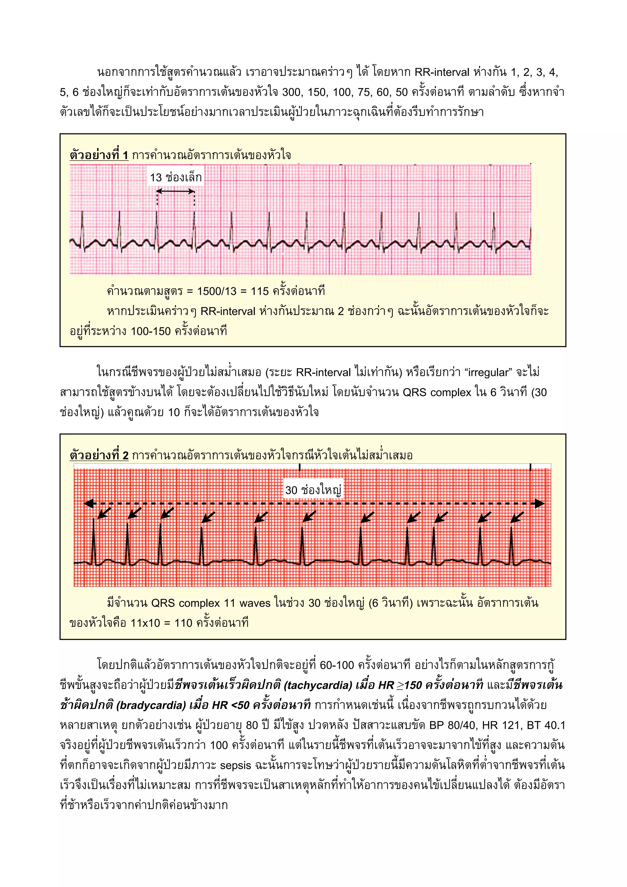EKG in ACLS | PDF