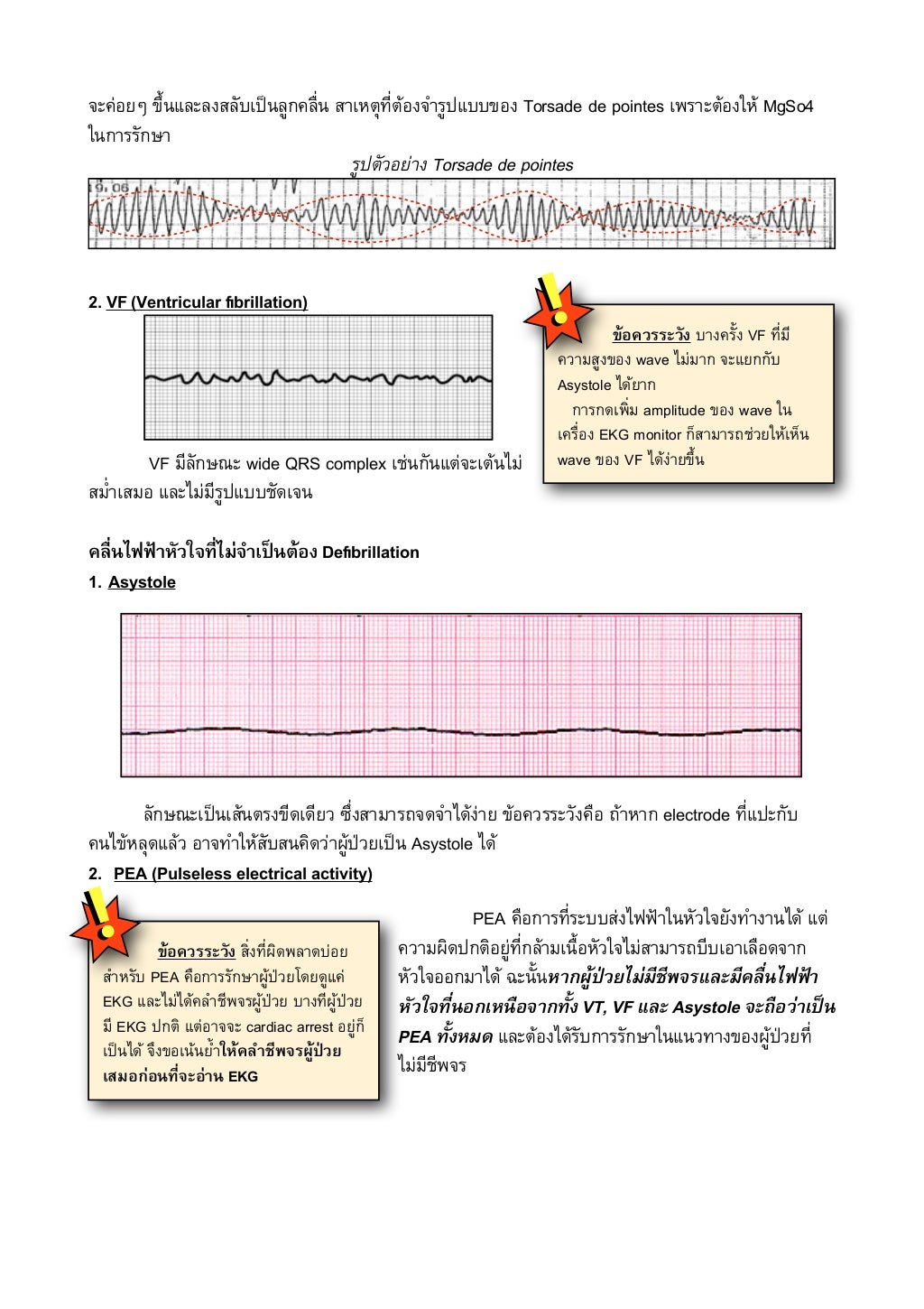 EKG in ACLS