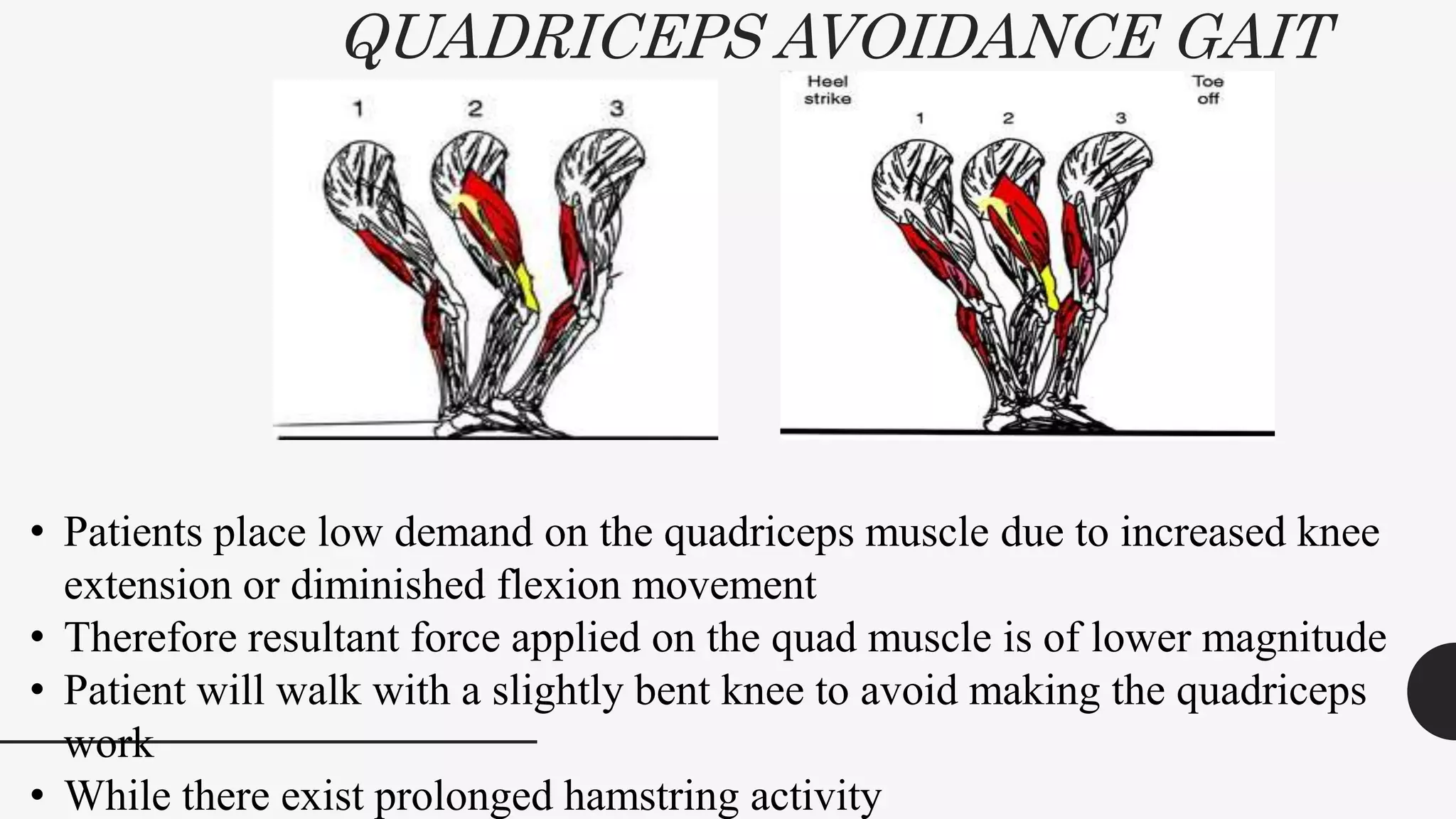 changes in gait pattern after injury and rehabilitation of the Anterior cruciate ligament | PPT
