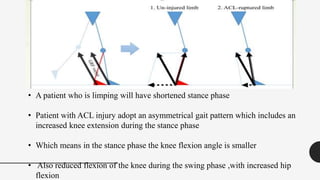 changes in gait pattern after injury and rehabilitation of the Anterior ...