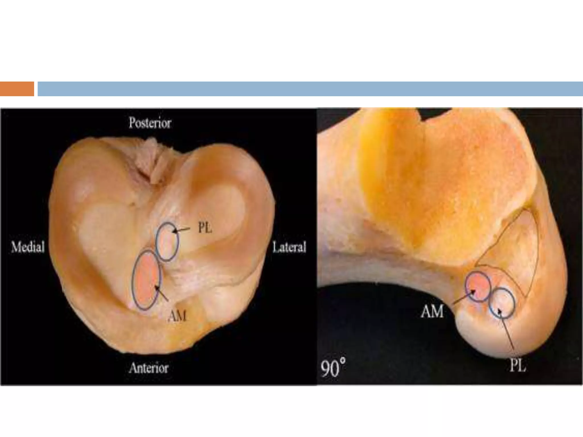 ACL INJURIES | PPTX