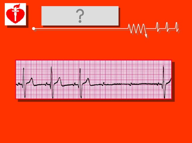 Acls mega code pdf | PDF | First Aid | Injuries