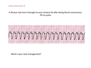 ACLS | PPTX
