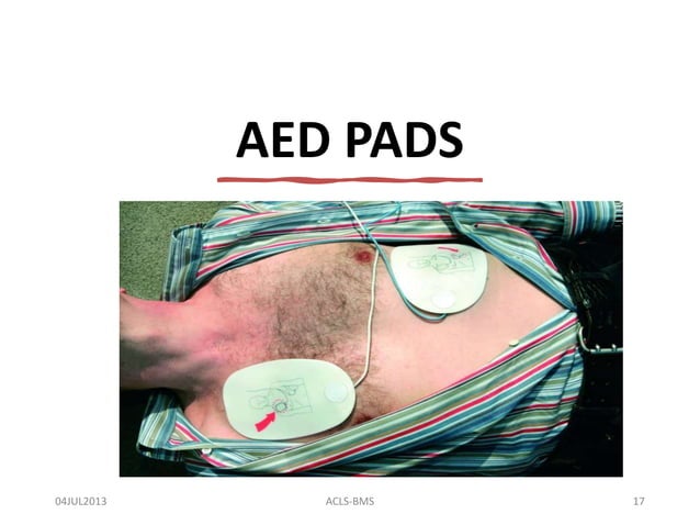 ACLS Presentation.pptx