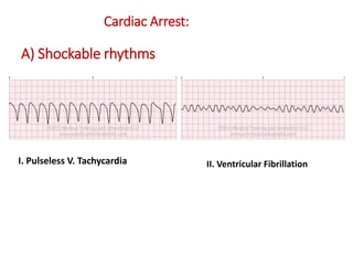 ACLs review.ppt