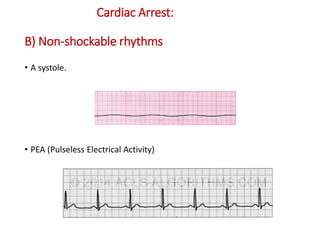 ACLs review.ppt