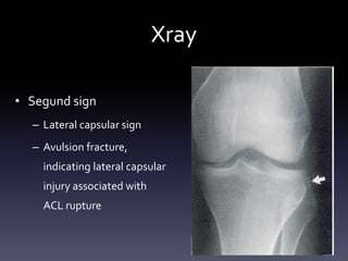 ACL Reconstruction - Update 2012 | PDF