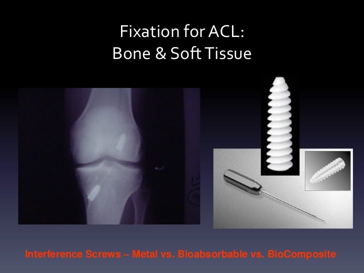 ACL Reconstruction - Update 2012