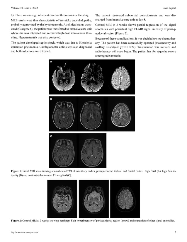 Coma Due to Wernicke Encephalopathy During Neoadjuvant Chemotherapy for ...