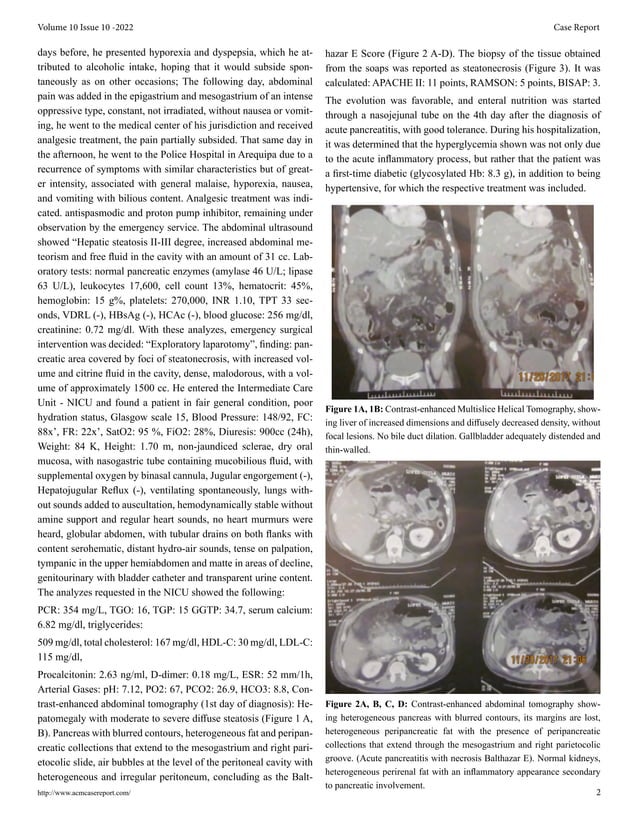 Severe Acute Pancreatitis with Normal Amylase and Lipase Levels, A Case ...
