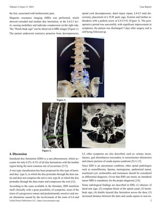 Intradural Disc Herniation, an Infrequent Spine Disease, Case Report | PDF