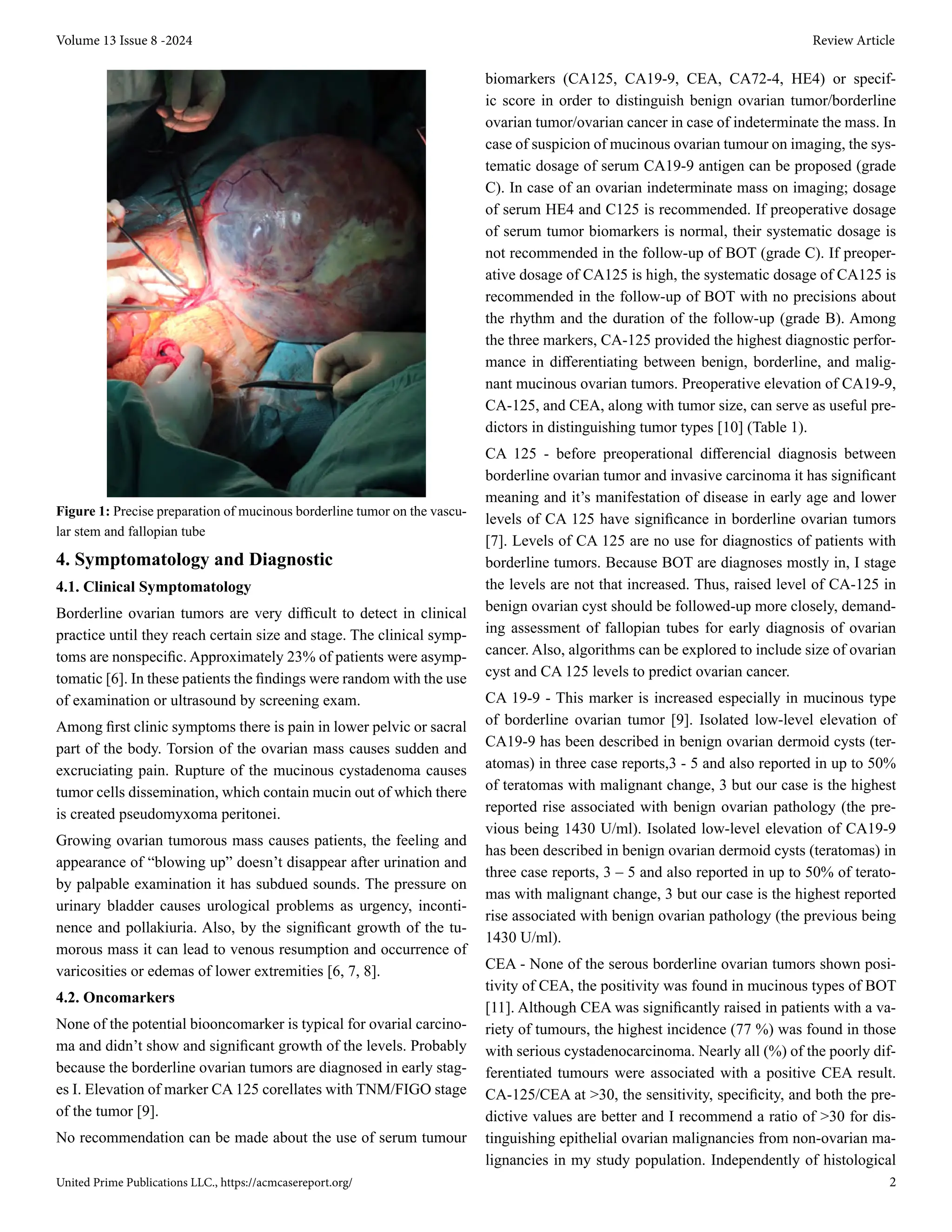 Borderline Ovarian Tumors – Diagnostic and Treatment Modalities | PDF