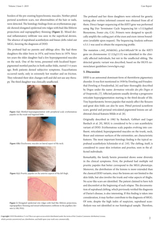 Keratin 5 Mutation in a Bulgarian Family with Dowling – Degos Disease ...