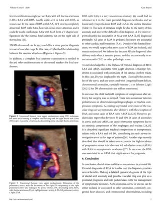 Fetal Vascular Rings: Beyond The Anomalies of The Aortic Arch | PDF