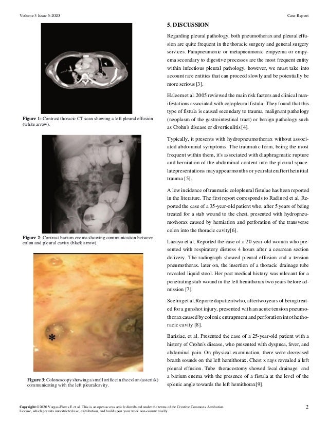 Colopleural Fistula. A Case Report and Review of Literature | PDF