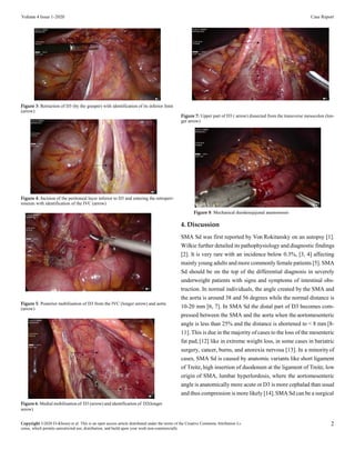 Superior Mesenteric Artery Syndrome Treated by Laparoscopic ...