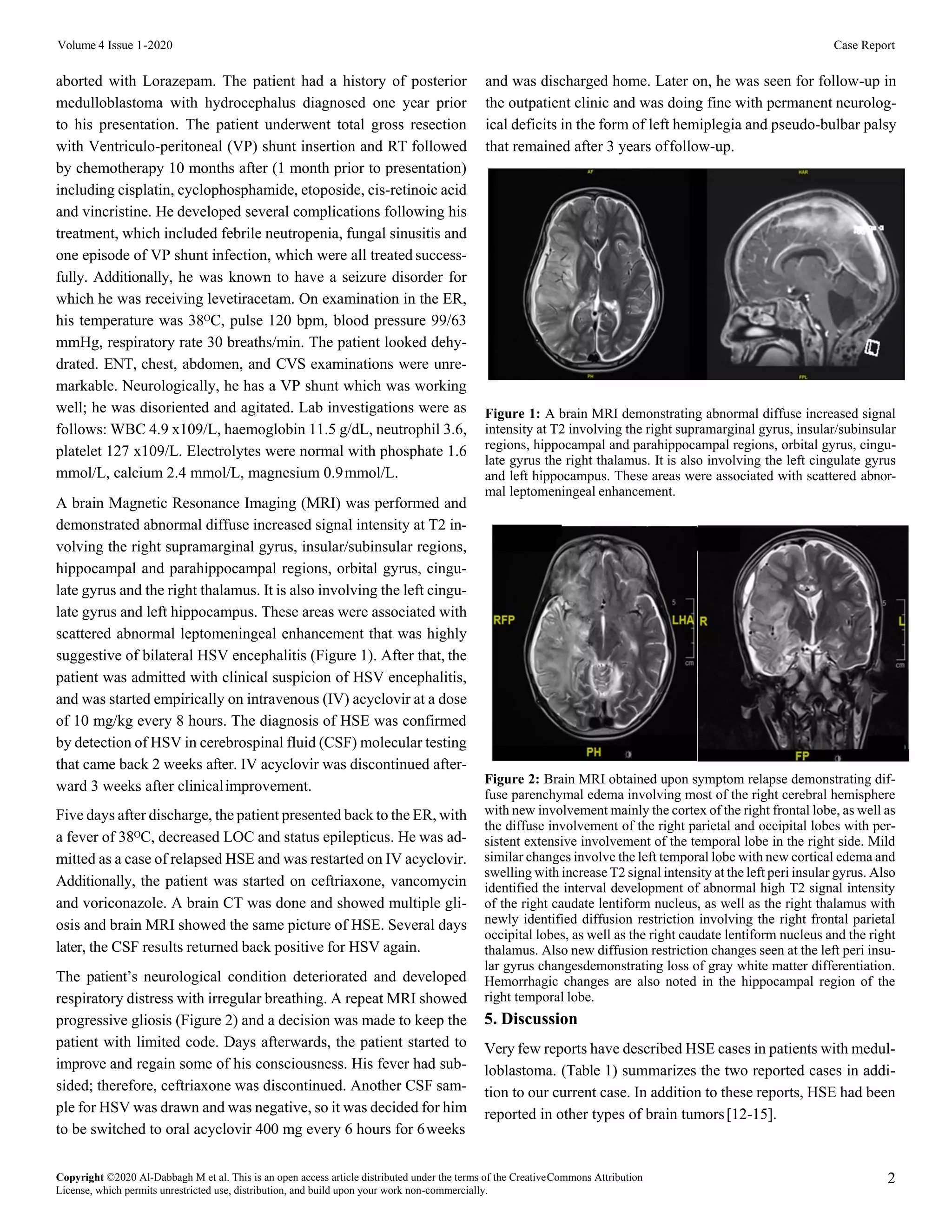 Herpes Simplex Encephalitis in Medulloblastoma Patients: Case Report ...