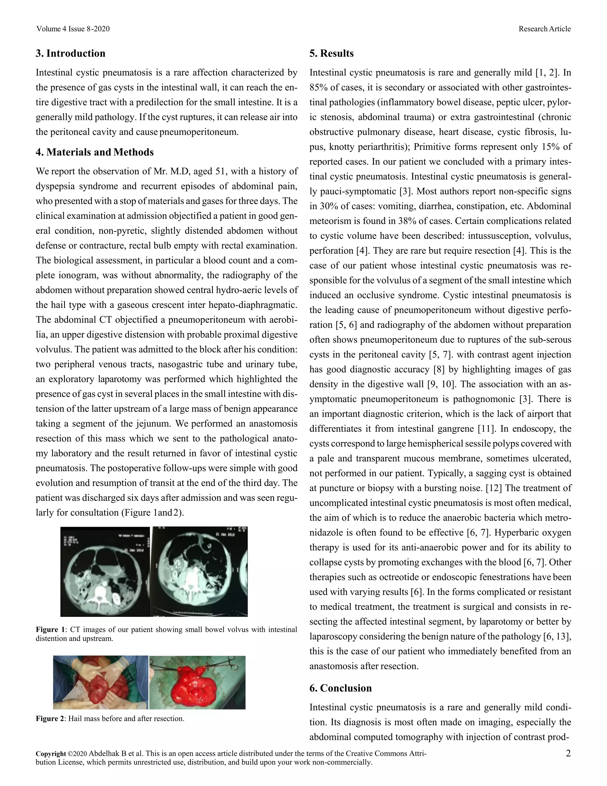 Intestinal Cystic Pneumatosis : Rare Case | PDF