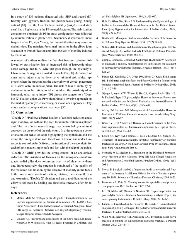 ‘Double X’ Cross Fixationin Paediatric Supracondylar Humerus Fractures ...