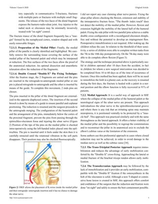 ‘Double X’ Cross Fixationin Paediatric Supracondylar Humerus Fractures ...