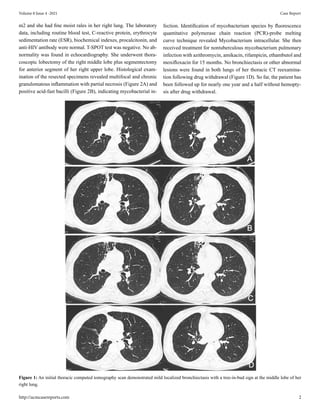 Repeated Hemoptysis With Progressive Bronchiectasis: A Case Report of ...
