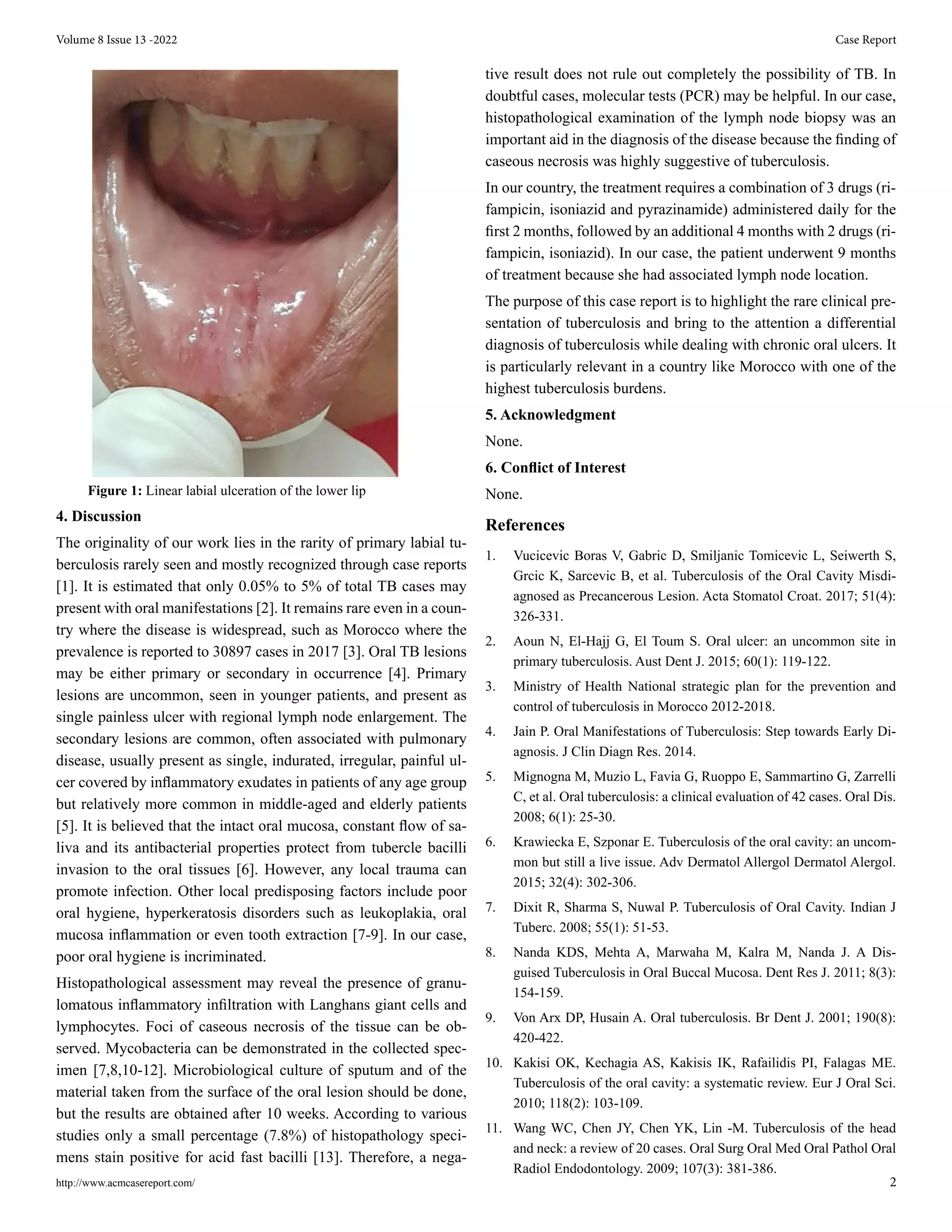 Tuberculosis: A Rare Cause of Linear Labial Ulceration | PDF