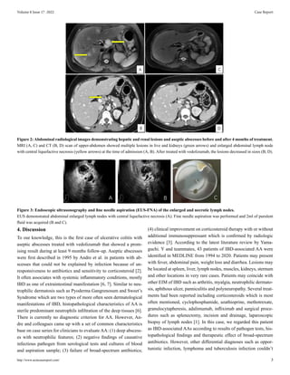 Ulcerative Colitis with Aseptic Abscesses Controlled by Vedolizumab: A ...
