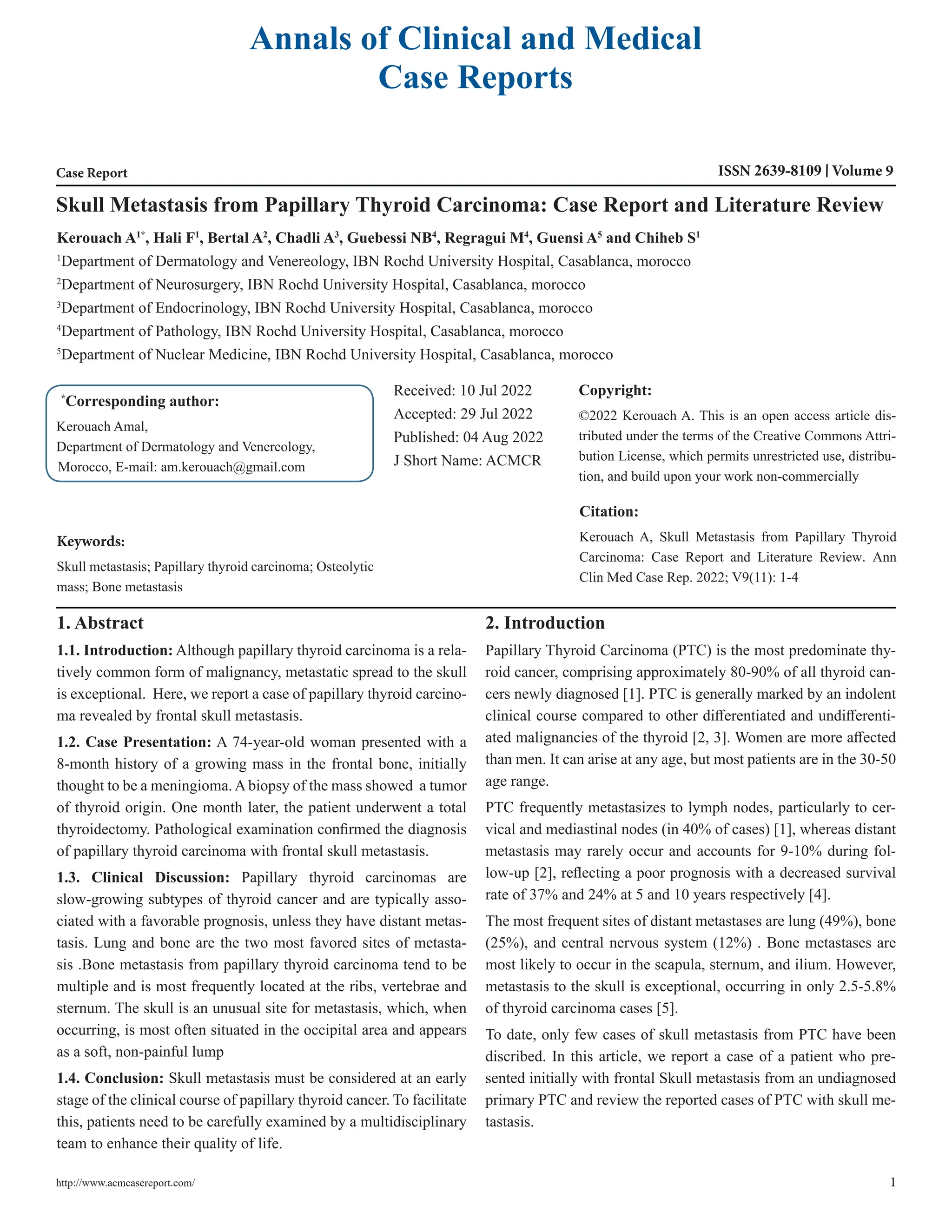 Skull Metastasis from Papillary Thyroid Carcinoma: Case Report and Literature Review | PDF