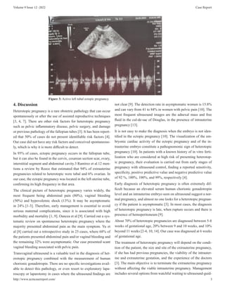 Heterotopic Pregnancy: Case Report | PDF