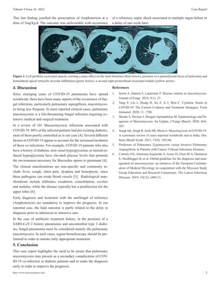 Post-COVID pulmonary mucormycosis- A case report | PDF