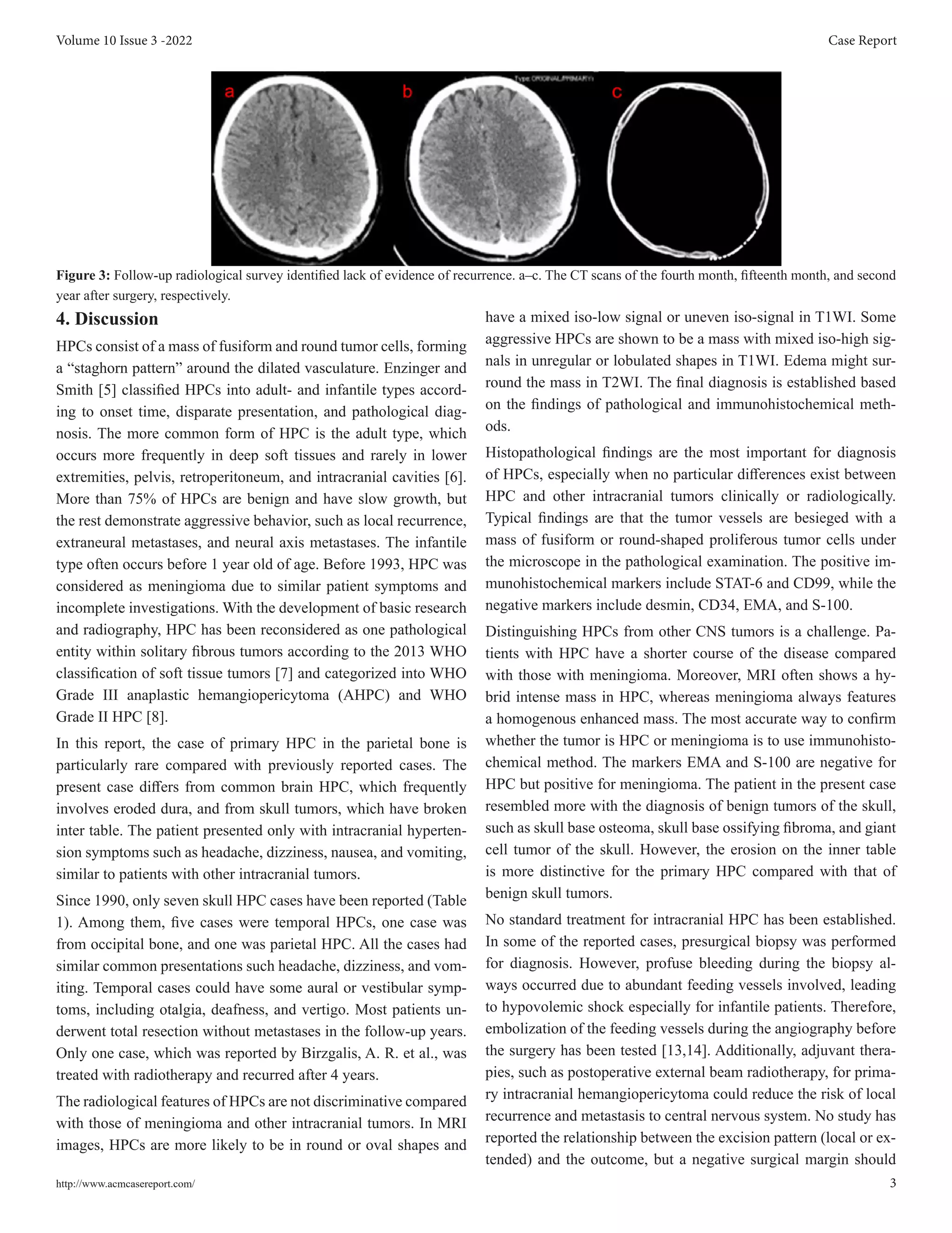 Primary Hemangiopericytoma in Parietal Bone: Literature Review and Case ...